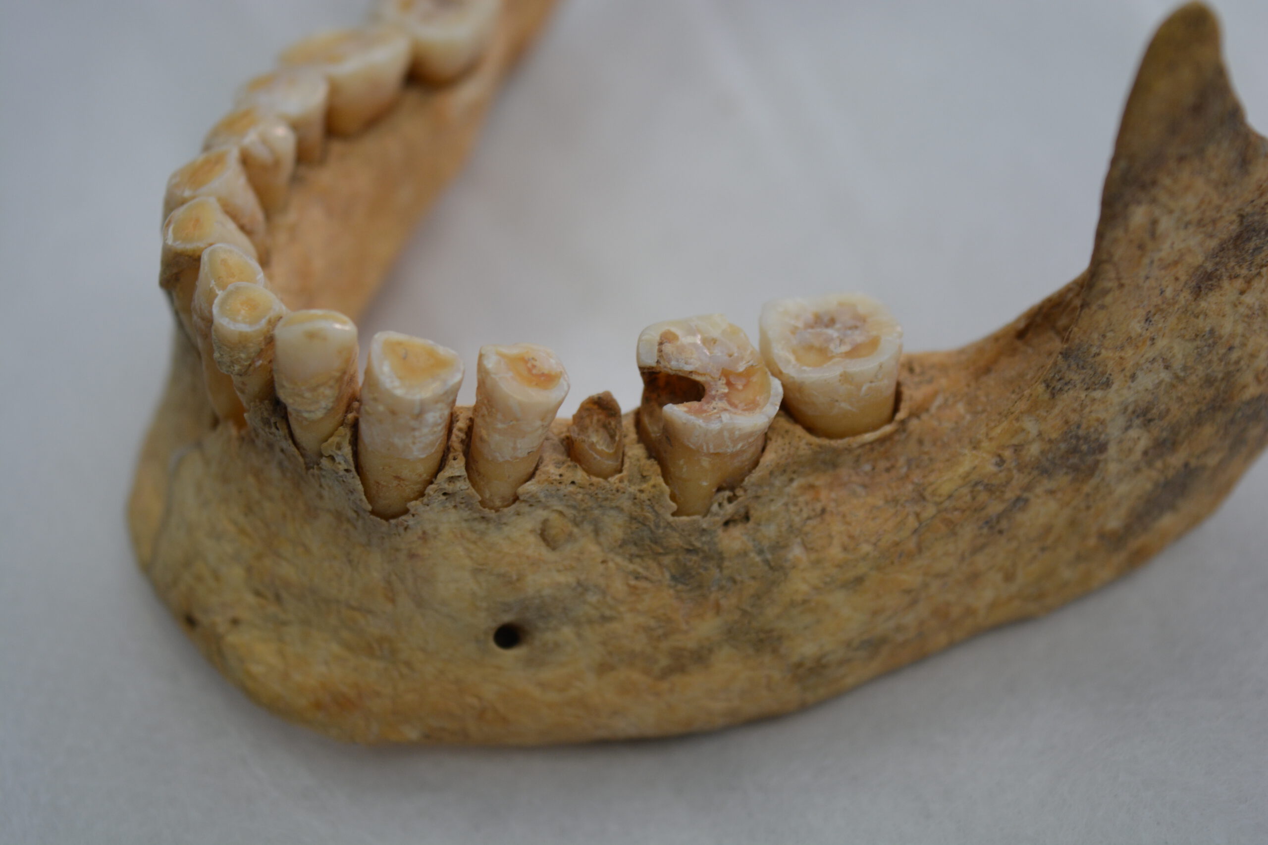 Zahnweh vor 7000 Jahren - Art & Science Krems